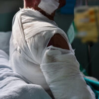 Colsen Recalls Fire Pits Due To Serious Burn Injury Hazard